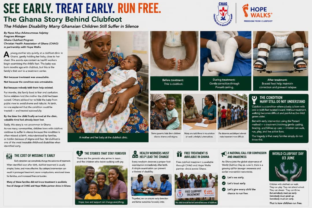 More than 9,000 Ghanaian children have been treated for clubfoot